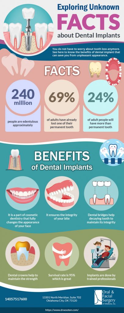 Exploring Unknown Facts About Dental Implants